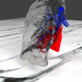 Lung with Pneumonia 3D Model: STL Files for 3D Printing - Lungs ...