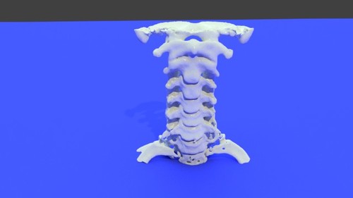 cervical spine STL file - Spine and Pelvis - embodi3D.com