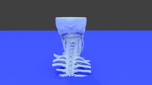 CTA Neck and skull base - Skull and Face - embodi3D.com