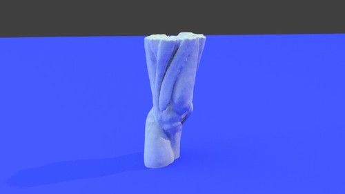 Muscles and soft tissues of the knee, with synovial sarcoma tumor ...