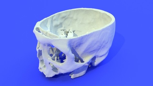 Base of the skull, STL file - Skull and Face - embodi3D.com