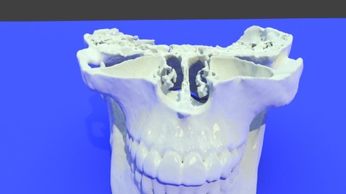 Highly Detailed Dental scan - Dental, Orthodontic, Maxillofacial ...