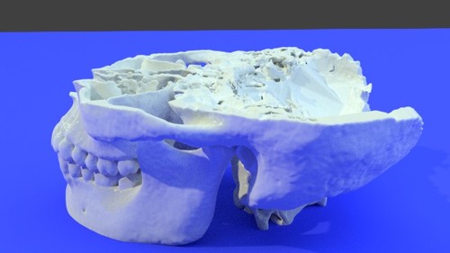 Highly Detailed Dental scan - Dental, Orthodontic, Maxillofacial ...