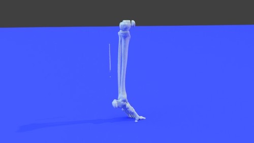 Left Leg Bone Model 3D Printable STL File Converted from CT Scan ...