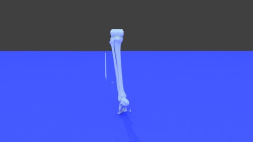 Left Leg Bone Model 3D Printable STL File Converted from CT Scan ...