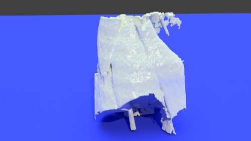 A 3D-printable medical file of a right thigh soft tissue sarcoma ...