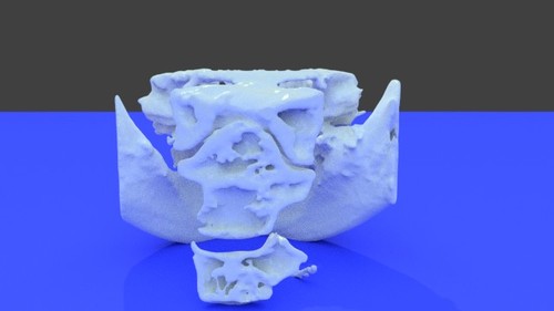 CT maxilla bone - stl file processed - Dental, Orthodontic ...