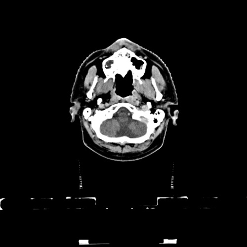 Head_scan - democratiz3D® Processing - embodi3D.com