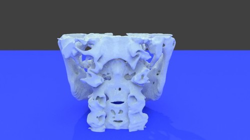 Dental Scan Nrrd File Stl File Processed Democratiz3d® Processing 