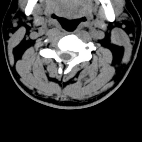 spine - democratiz3D® Processing - embodi3D.com