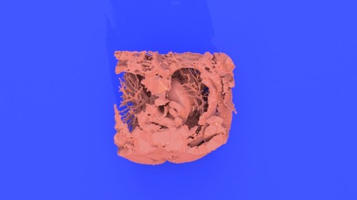 CT scans - stl file processed - democratiz3D® Processing - embodi3D.com