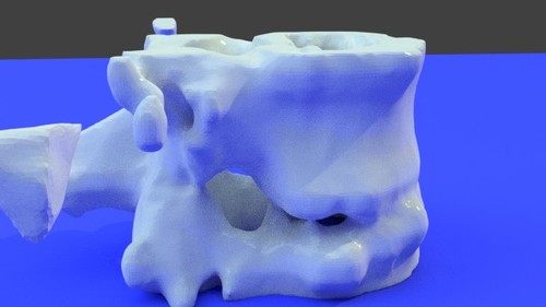L1 vertebra - Bone model STL file from converted CT scan - Spine and ...