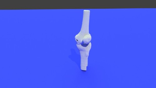 Left knee - Bone model STL file from converted CT scan - Extremity ...