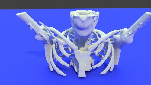 Chest CTA - stl file processed - democratiz3D® Processing - embodi3D.com