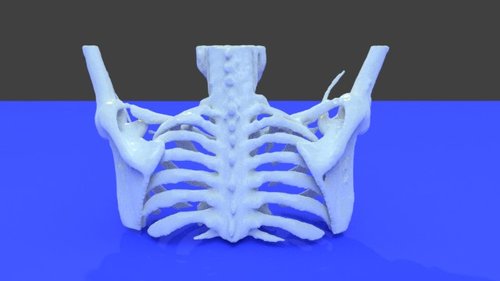 Chest CTA - stl file processed - democratiz3D® Processing - embodi3D.com