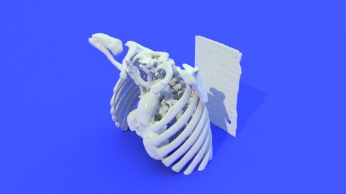 angio HPP - stl file processed - Congenital Heart Defects - embodi3D.com