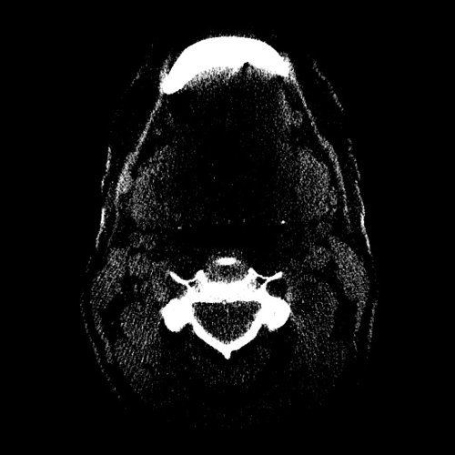 Jaw Scan 4442 - democratiz3D® Processing - embodi3D.com