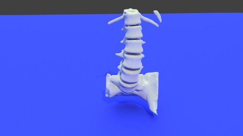 LSTV 3D CT Scan - stl file processed - Spine and Pelvis - embodi3D.com