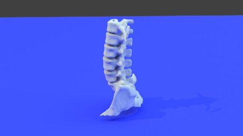 LSTV 3D CT Scan - stl file processed - Spine and Pelvis - embodi3D.com