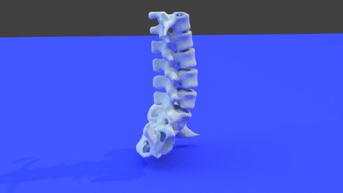 LSTV 3D CT Scan - stl file processed - Spine and Pelvis - embodi3D.com