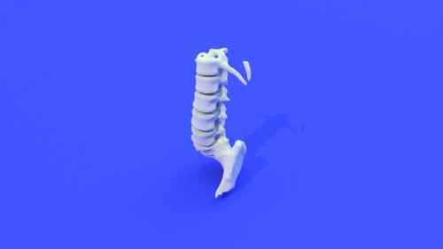 LSTV 3D CT Scan - stl file processed - Spine and Pelvis - embodi3D.com