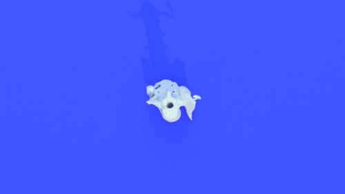 LSTV 3D CT Scan - stl file processed - Spine and Pelvis - embodi3D.com