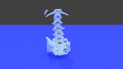 LSTV 3D CT Scan - stl file processed - Spine and Pelvis - embodi3D.com