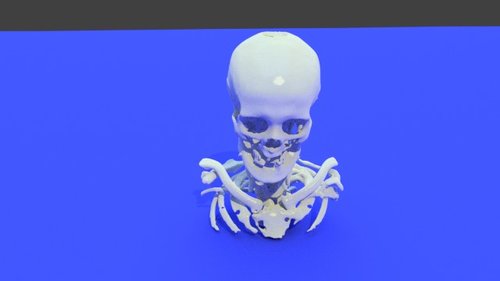Head and Neck CT - stl file processed - democratiz3D® Processing ...