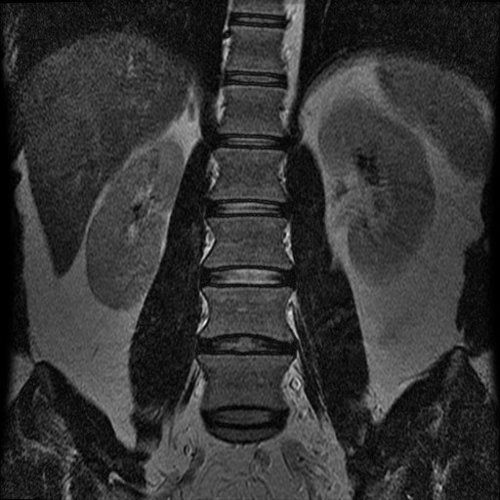 Columna - MRIs - embodi3D.com
