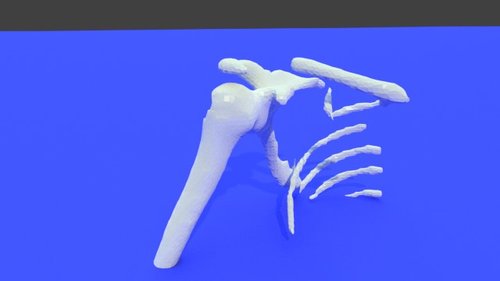 7 - stl file processed - Extremity, Upper (Arm) - embodi3D.com