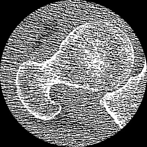 CT HIP - democratiz3D® Processing - embodi3D.com