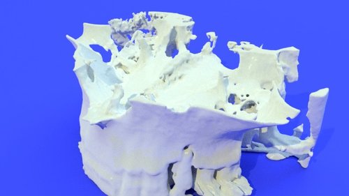 Mandible Complete - stl file processed - Dental, Orthodontic ...