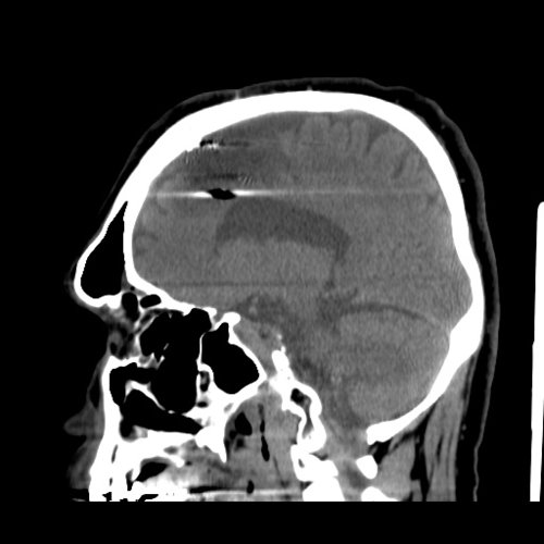 craniodeformity - Skull, Head, and Neck CTs - embodi3D.com