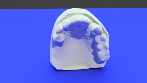 Cindy Osterhout - stl file processed - Dental, Orthodontic ...