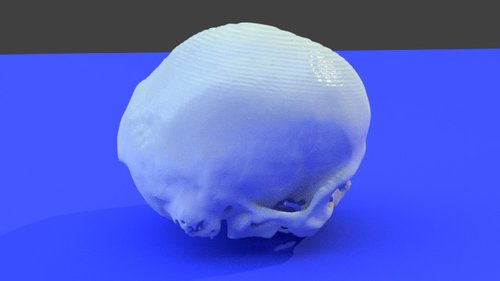 Skull dicom - stl file processed - Skull and Face - embodi3D.com