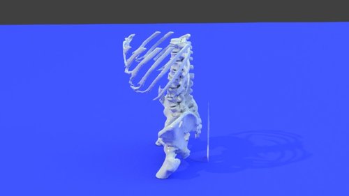 abdomen scans - stl file processed - Abdomen and Pelvis CTs - embodi3D.com
