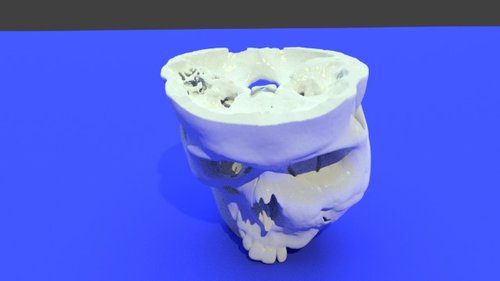 Skull - stl file processed - Dental, Orthodontic, Maxillofacial ...