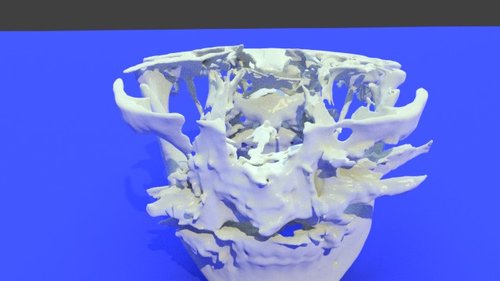 CT scan for dental implant surgical guide - stl file processed - Dental ...