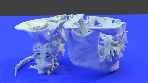 CT scan for dental implant surgical guide - stl file processed - Dental ...