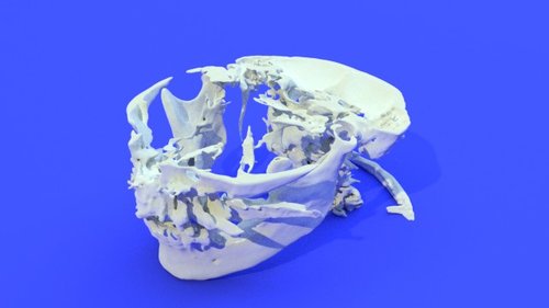 CT scan for dental implant surgical guide - stl file processed - Dental ...