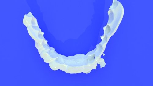 JY bite - stl file processed - Dental, Orthodontic, Maxillofacial - embodi3D.com