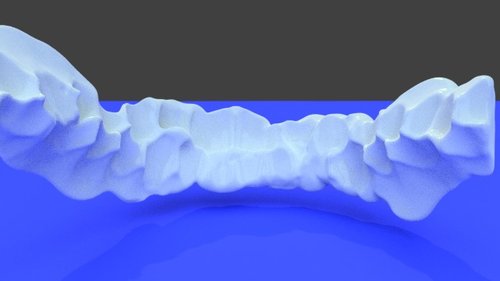 JY bite - stl file processed - Dental, Orthodontic, Maxillofacial - embodi3D.com