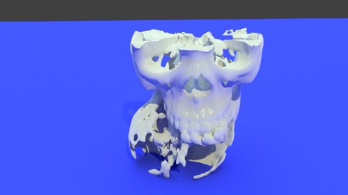 e2 - stl file processed - Dental, Orthodontic, Maxillofacial - embodi3D.com