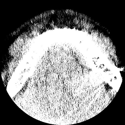 1 3D CBCT Image Set_2 - Skull, Head, and Neck CTs - embodi3D.com