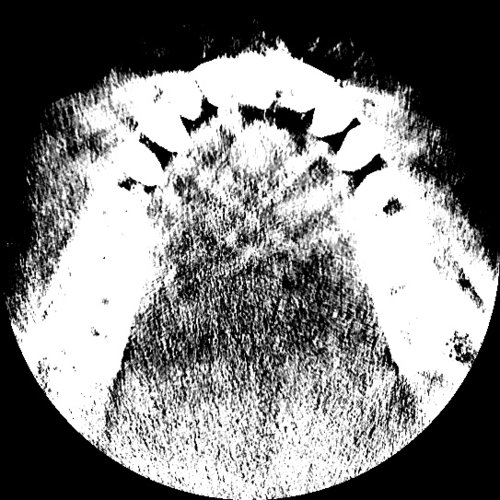 1 3D CBCT Image Set_2 - Skull, Head, and Neck CTs - embodi3D.com