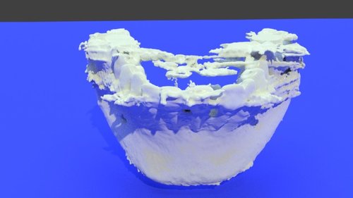 1 3D CBCT Image Set_2 - stl file processed - Dental, Orthodontic ...