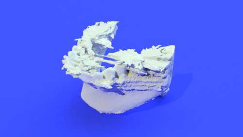 1 3D CBCT Image Set_2 - stl file processed - Dental, Orthodontic ...