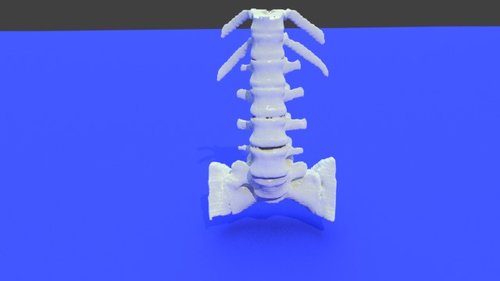Bertolotti's Syndrome Spine - stl file processed - Spine CTs - embodi3D.com
