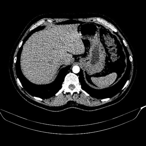 Lung_bones_ct - Thorax CTs - embodi3D.com
