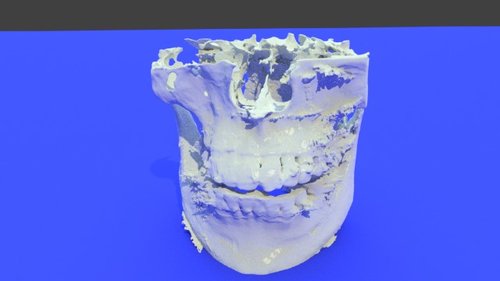 CT Dental - stl file processed - Dental, Orthodontic, Maxillofacial ...